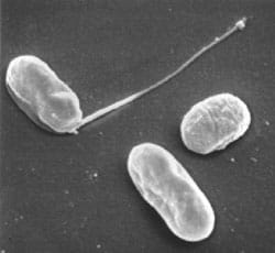 Enfermedades en Conejos: La Encefalitozoonosis - Kiwi Exóticos